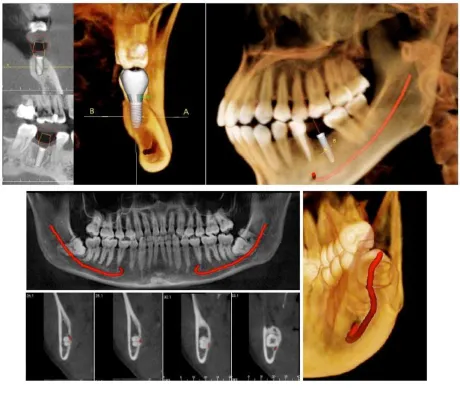 i-CAT® 3D imaging Medford OR, Associates for Oral & Maxillofacial Surgery